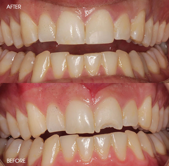 Smile Gallery Perth | Bayview Dental Claremont, Perth