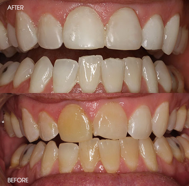 Smile Gallery Perth | Bayview Dental Claremont, Perth