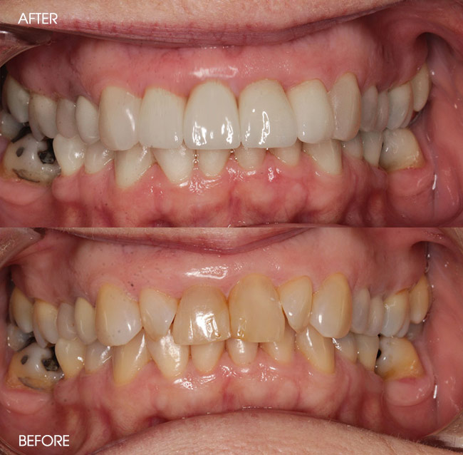 Smile Gallery Perth | Bayview Dental Claremont, Perth