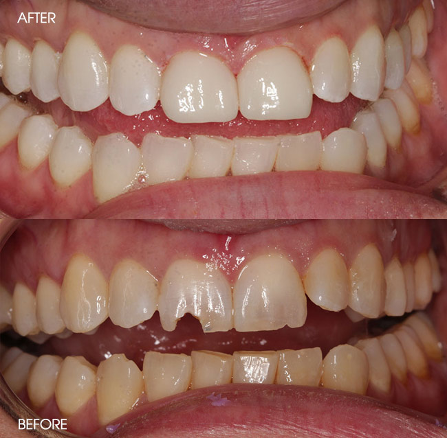 Smile Gallery Perth | Bayview Dental Claremont, Perth