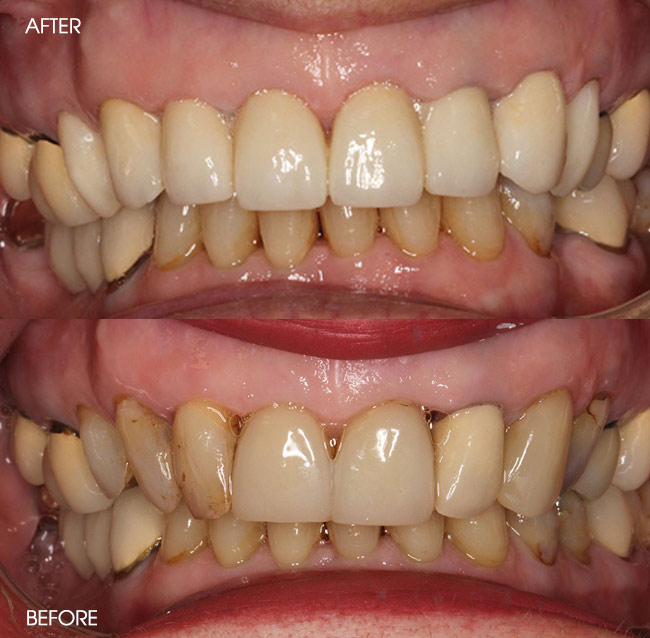 Smile Gallery Perth | Bayview Dental Claremont, Perth