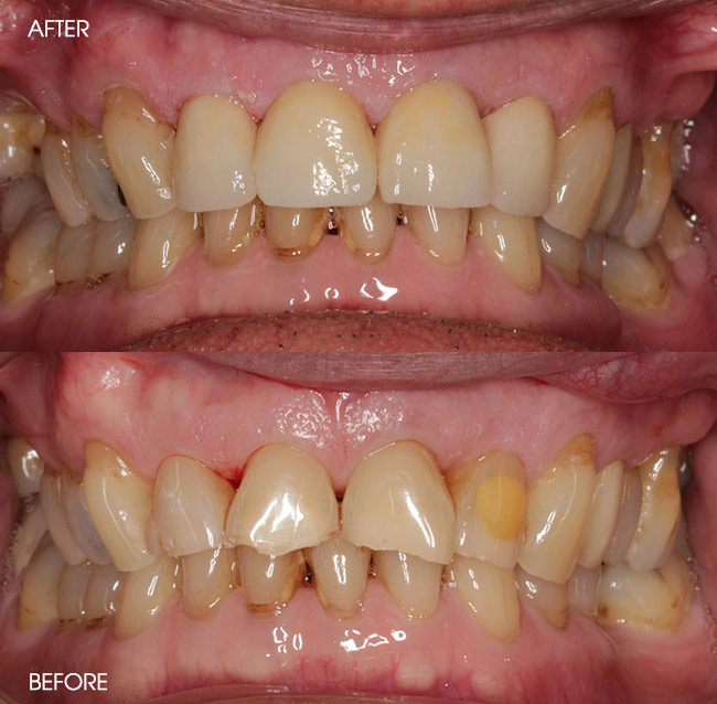 Smile Gallery Perth | Bayview Dental Claremont, Perth