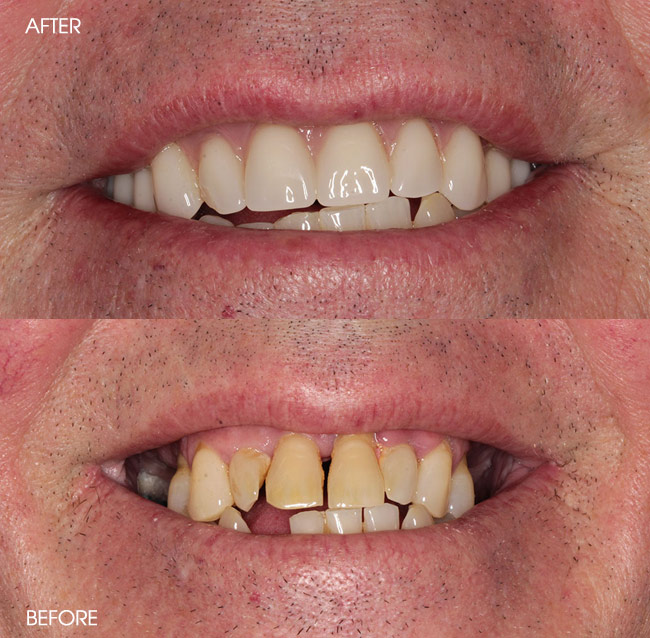 Smile Gallery Perth | Bayview Dental Claremont, Perth