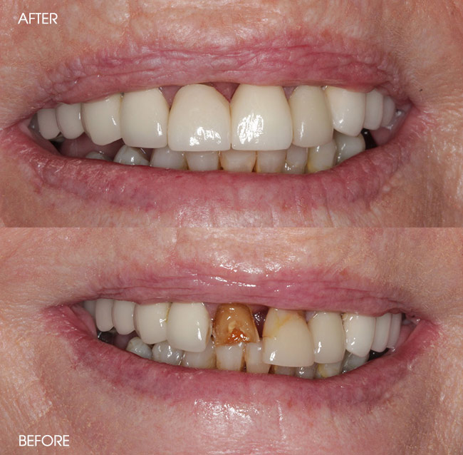 Smile Gallery Perth | Bayview Dental Claremont, Perth