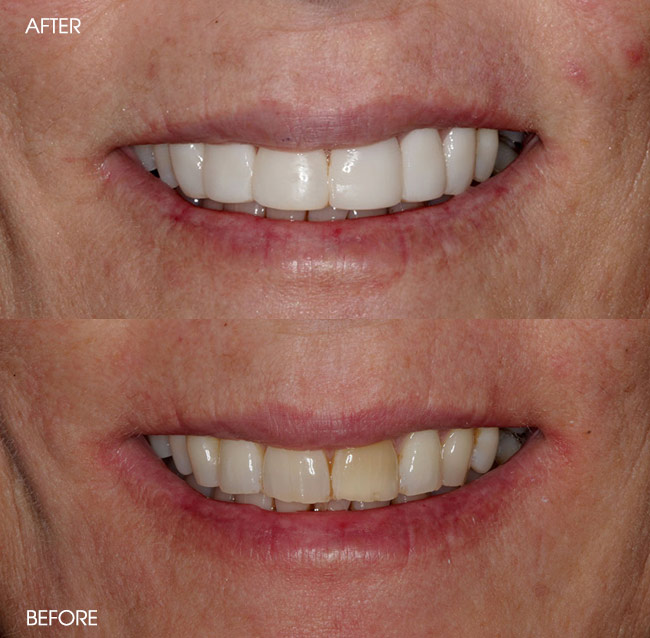 Smile Gallery Perth | Bayview Dental Claremont, Perth