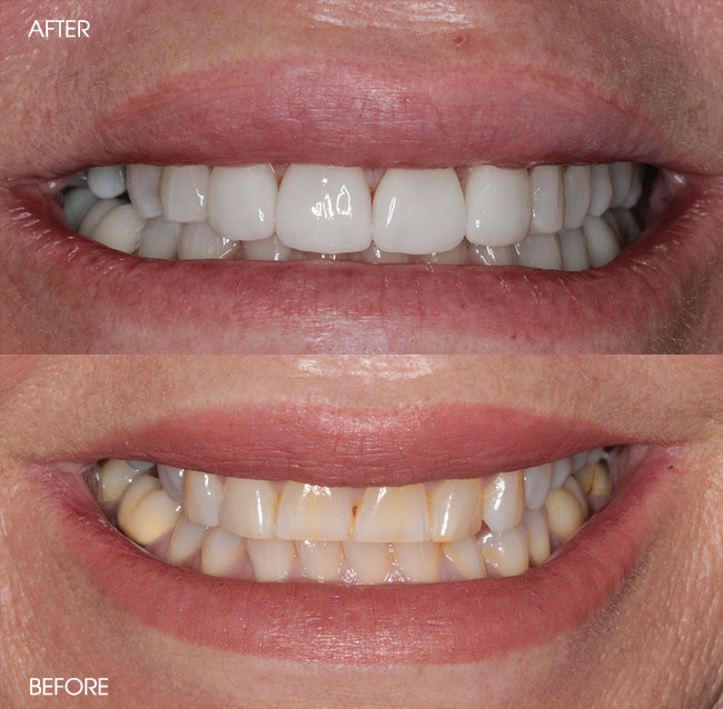 Smile Gallery Perth | Bayview Dental Claremont, Perth